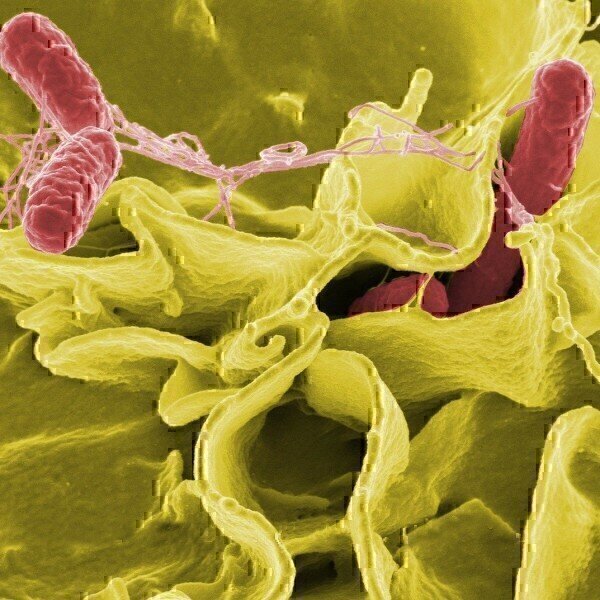 12 Diseases Caused by Water Pollution Envirotech Online